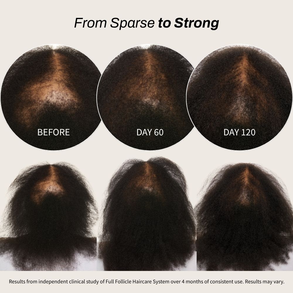 Hair Regrowth Decoded: The Deep Guide to Scalp & Hair Science – Maelove Skincare